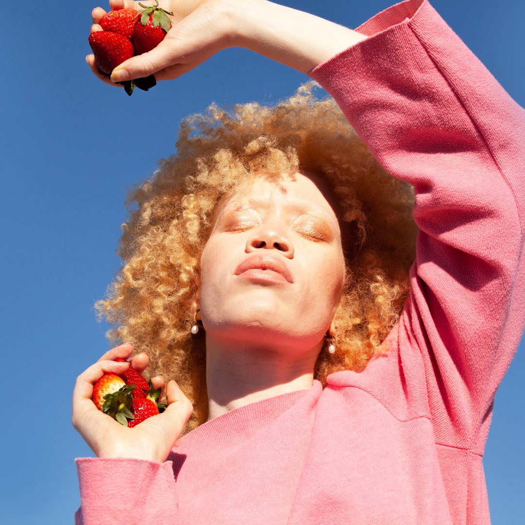 Blind Low Vision NZ - Albinism: A Clear Guide to the Condition