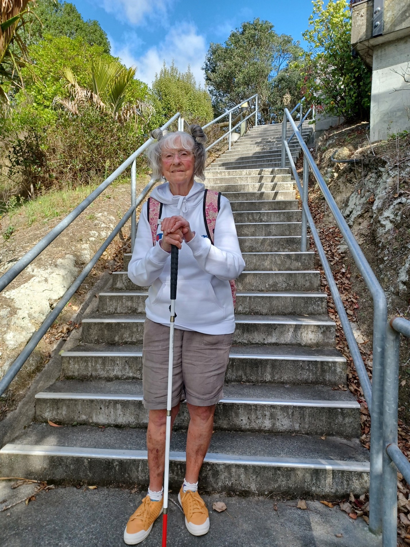 Blind Low Vision NZ - Lisa's Vision Loss Journey